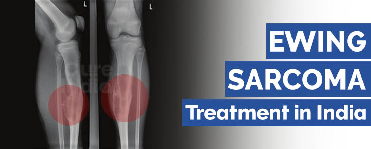 is ewing sarcoma curable