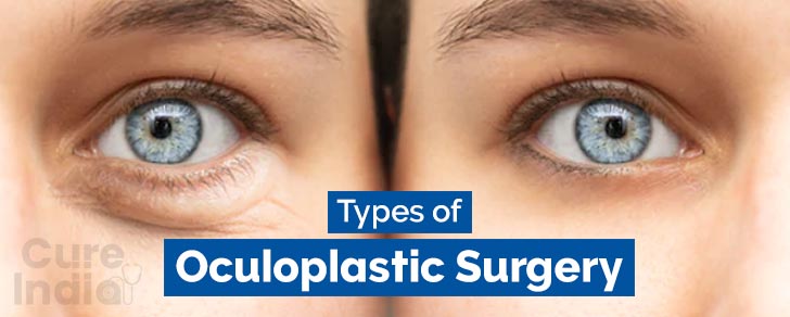 Oculoplastic Surgery | Treatment and Cost in India