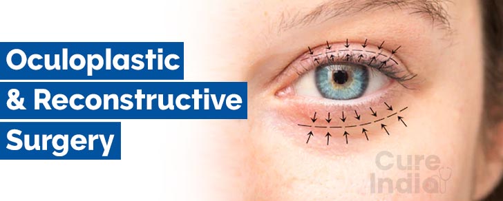 Oculoplastic Surgery | Treatment and Cost in India