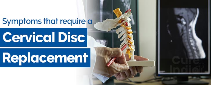 Cervical Disc Replacement Surgery in India | Surgery Recovery Time & Cost