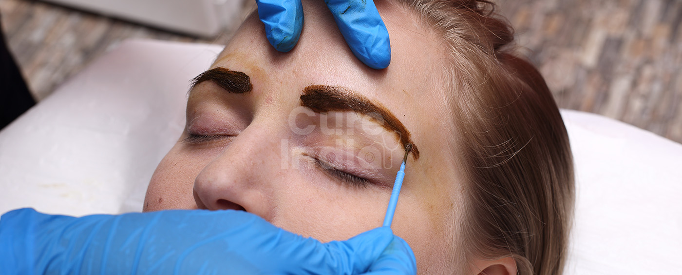 Eyebrow Reconstruction | Recovery, Side Effects & Procedure