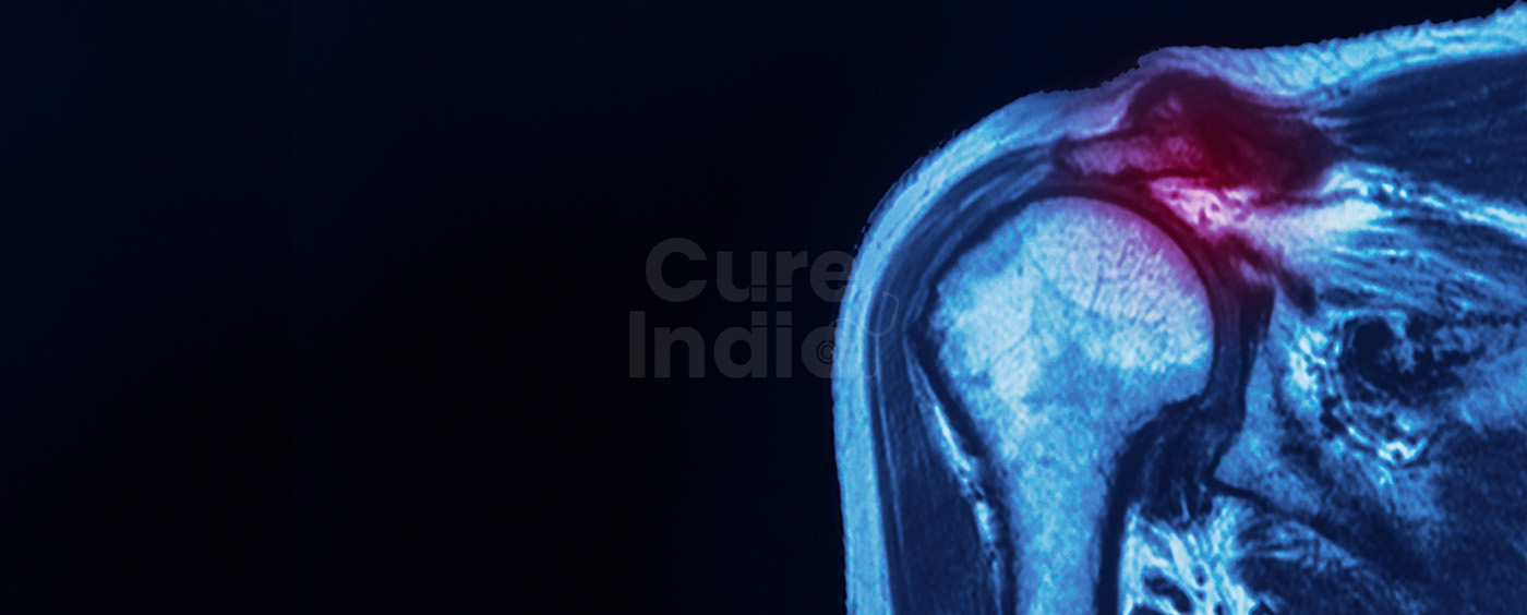 Arthroscopic Rotator Cuff Repair Surgery in India - Cost & Best ...