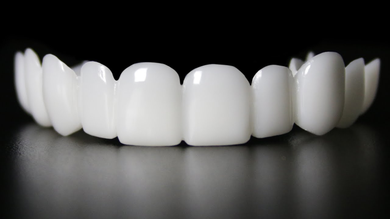 Snap-On Smile | Attractive Smile Technique