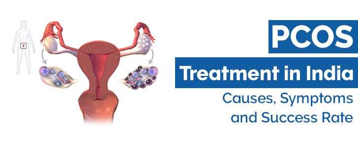 PCOS treatment in India - Causes, Symptoms & Success Rate | CureIndia