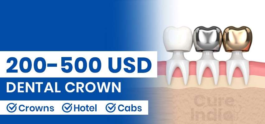 How Much Is A Dental Crown? $200–$500 | CureIndia