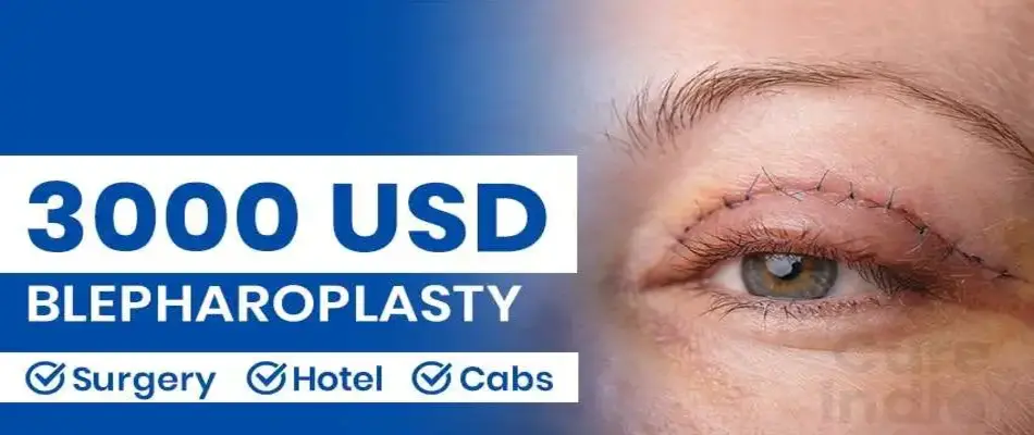 Affordable Blepharoplasty Cost - $2,000-$2,500 | CureIndia
