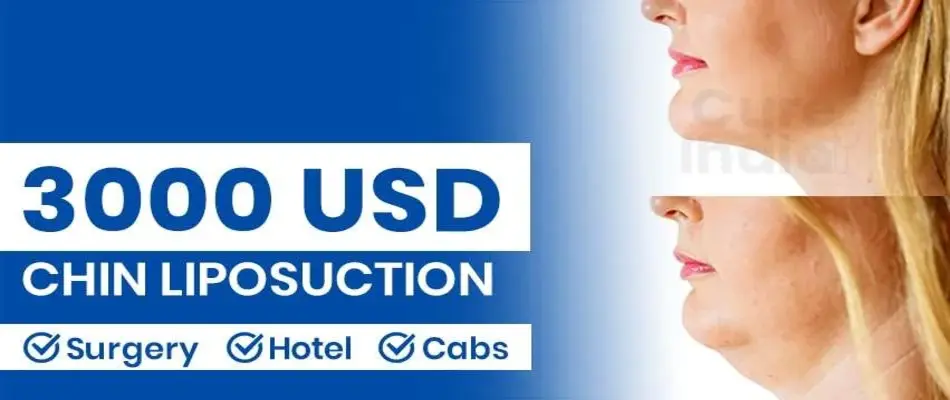 Average Cost Of Chin Liposuction $2000 | CureIndia