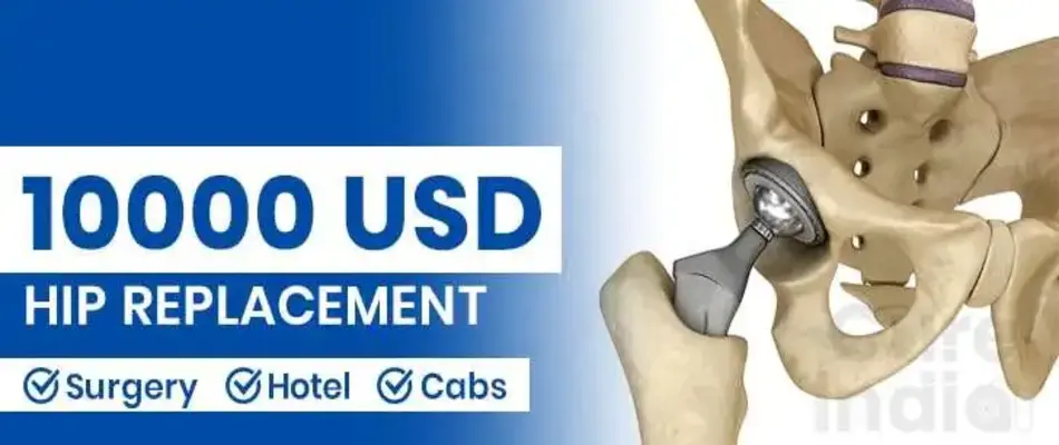 Hip Replacement Surgery Cost - $5,000 Single $10,000 Both | CureIndia