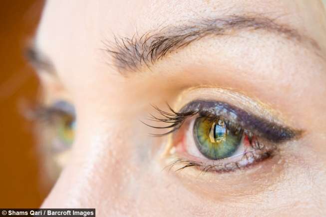 Permanent Eye Color Change Surgery | Iris implant surgery in India
