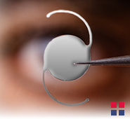 Monofocal Lens Replacement in Turkey | CureTurkey